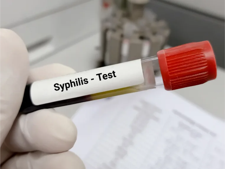 Syphilis Symptoms in Men and Women | Early Warning Signs Explained ...
